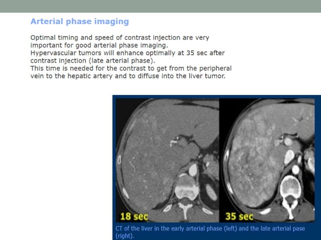 TRIPLE PHASE CT AND ITS TECHNIQUE BY VANI PUSHPA (2).pptx