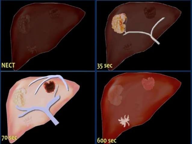 TRIPLE PHASE CT AND ITS TECHNIQUE BY VANI PUSHPA (2).pptx