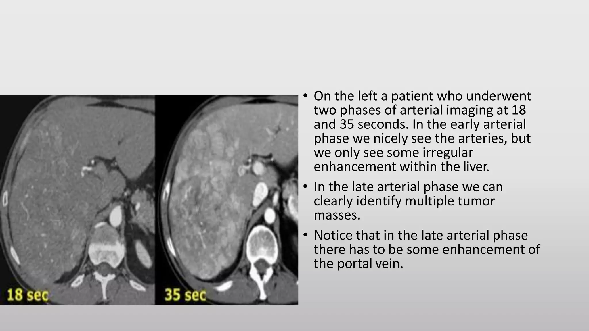 Triple phase ct PowerPoint slide PPT pk | PPTX