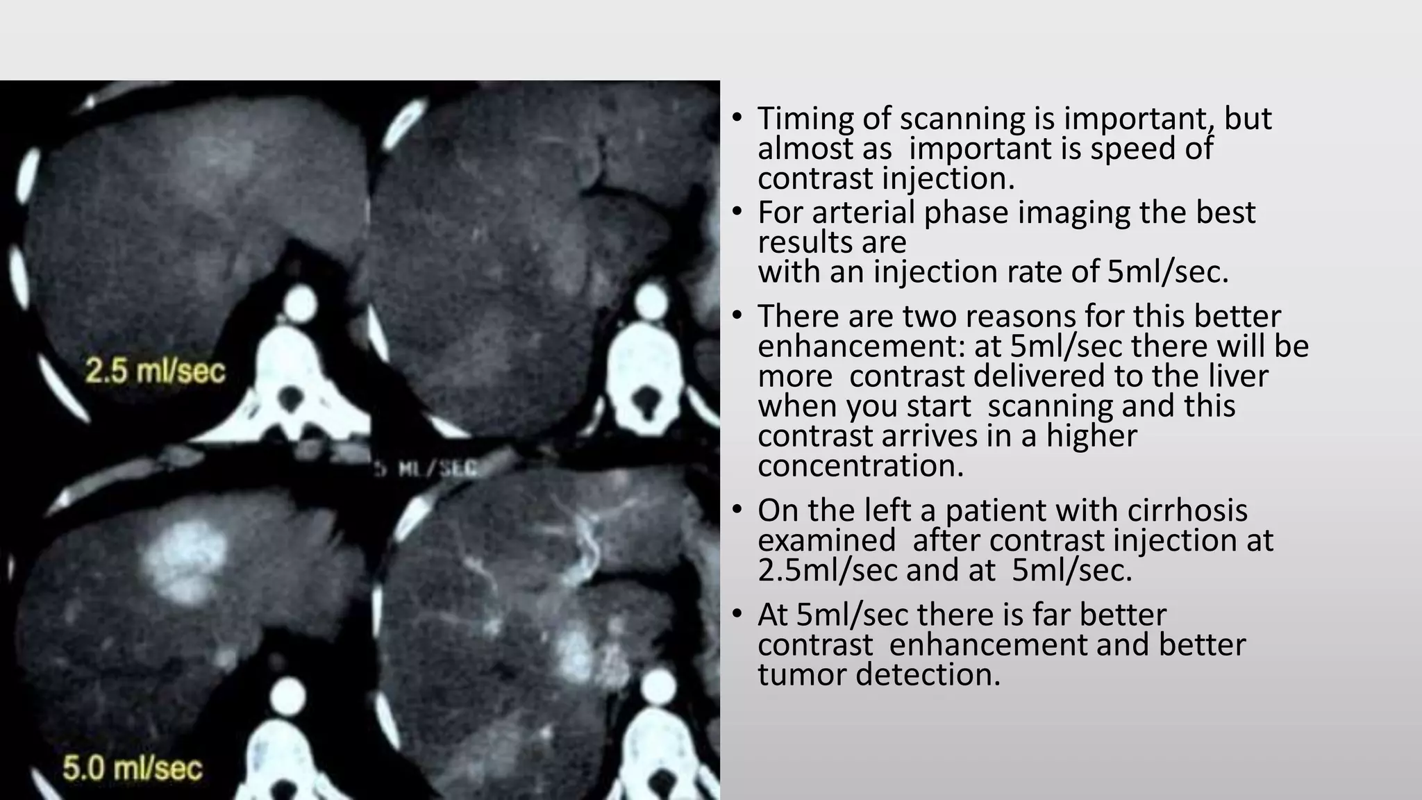 Triple phase ct PowerPoint slide PPT pk | PPTX