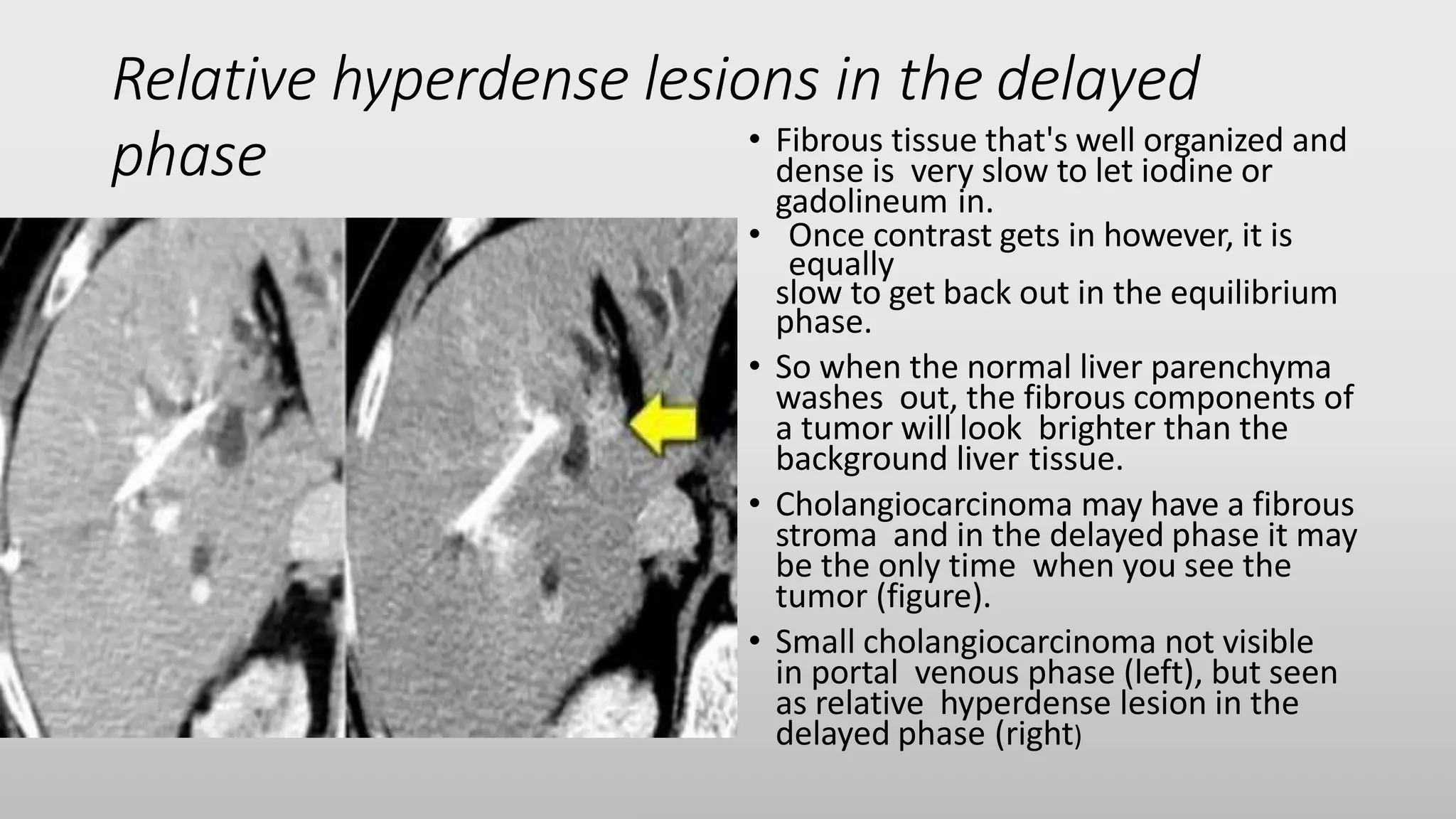 Triple phase ct PowerPoint slide PPT pk | PPTX