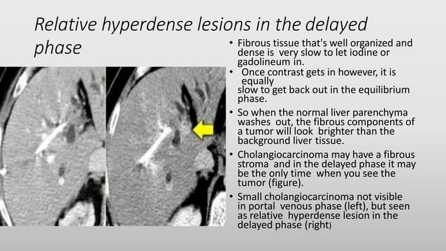 Triple phase ct PowerPoint slide PPT pk | PPTX