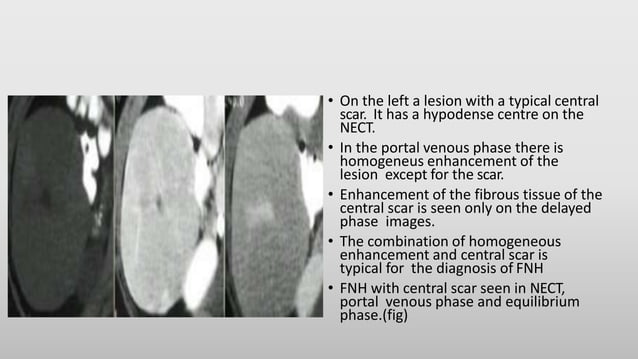 Triple phase ct PowerPoint slide PPT pk | PPTX