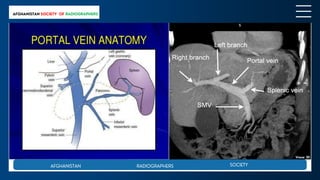 TRIPLE PHASE CT TECHNIQUE for ct scan technicians .pdf