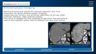 TRIPLE PHASE CT TECHNIQUE for ct scan technicians .pdf