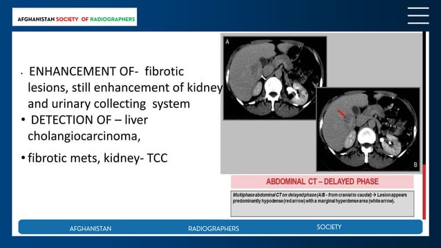 TRIPLE PHASE CT TECHNIQUE for ct scan technicians .pdf