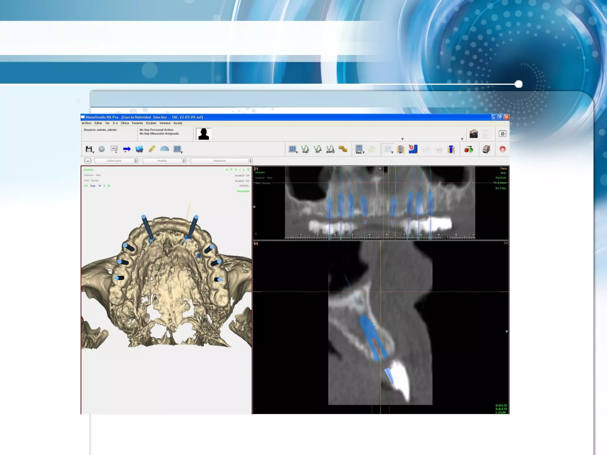 triple scan protocol (Dr. Gross) - a new and effective protocol for 3D ...