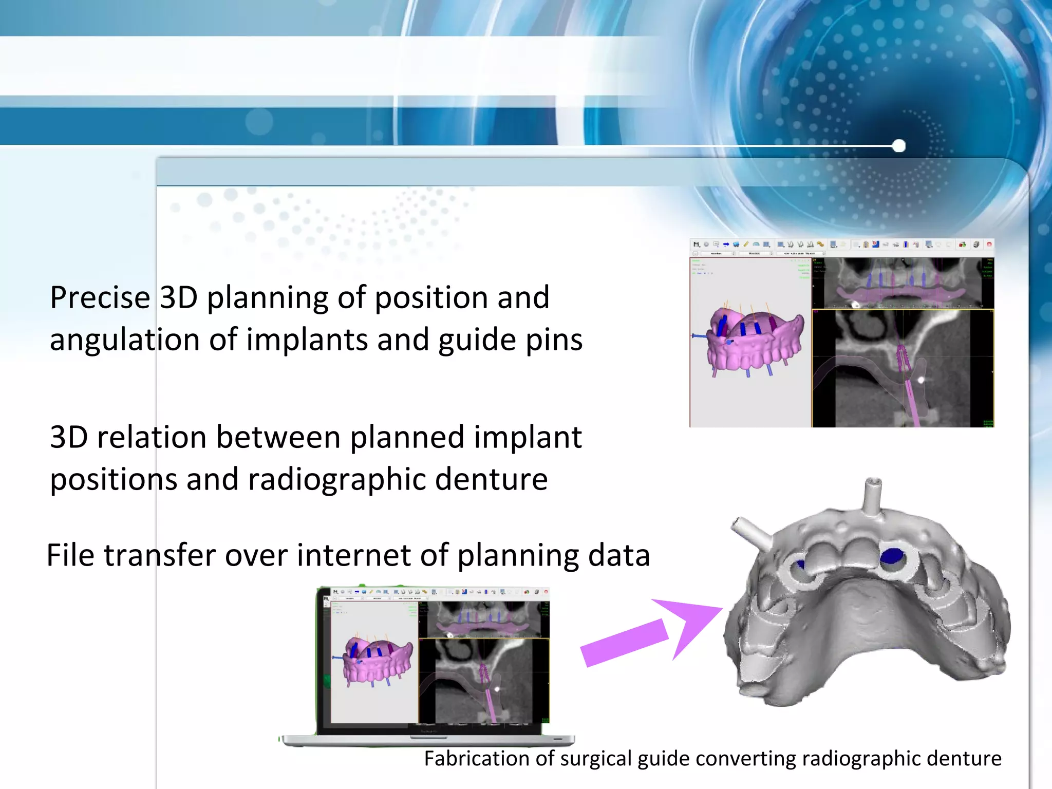 triple scan protocol (Dr. Gross) - a new and effective protocol for 3D ...