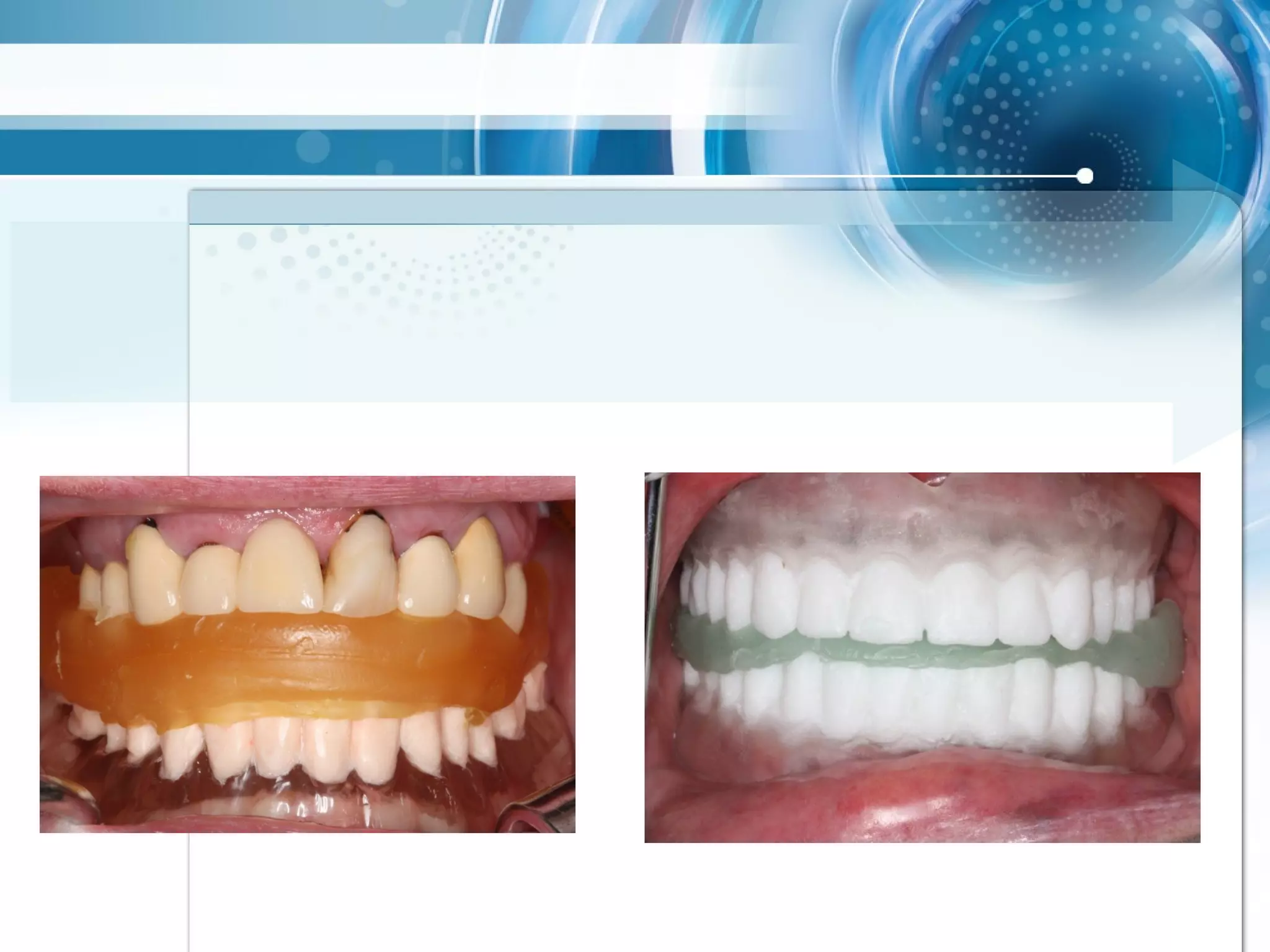 triple scan protocol (Dr. Gross) - a new and effective protocol for 3D ...