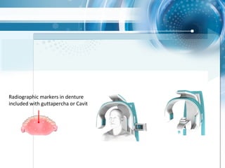 triple scan protocol (Dr. Gross) - a new and effective protocol for 3D ...