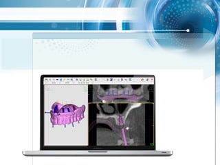 triple scan protocol (Dr. Gross) - a new and effective protocol for 3D ...