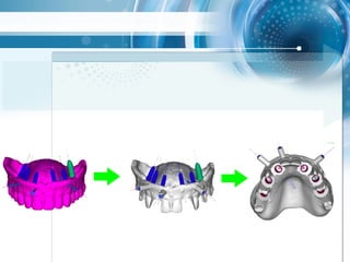 triple scan protocol (Dr. Gross) - a new and effective protocol for 3D ...