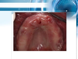 triple scan protocol (Dr. Gross) - a new and effective protocol for 3D ...