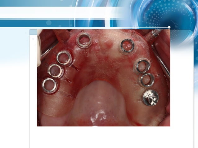 triple scan protocol (Dr. Gross) - a new and effective protocol for 3D ...
