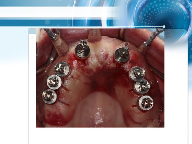 triple scan protocol (Dr. Gross) - a new and effective protocol for 3D ...