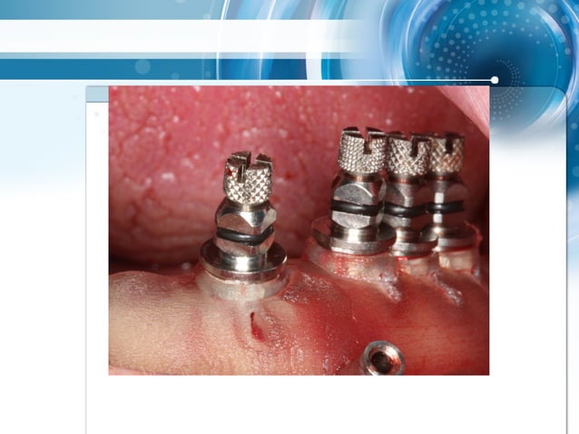 triple scan protocol (Dr. Gross) - a new and effective protocol for 3D ...