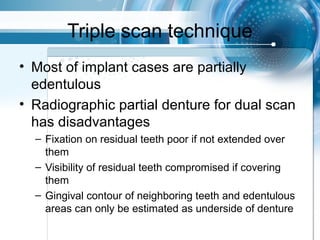 triple scan protocol (Dr. Gross) - a new and effective protocol for 3D ...