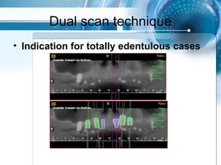 triple scan protocol (Dr. Gross) - a new and effective protocol for 3D ...