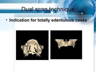 triple scan protocol (Dr. Gross) - a new and effective protocol for 3D ...
