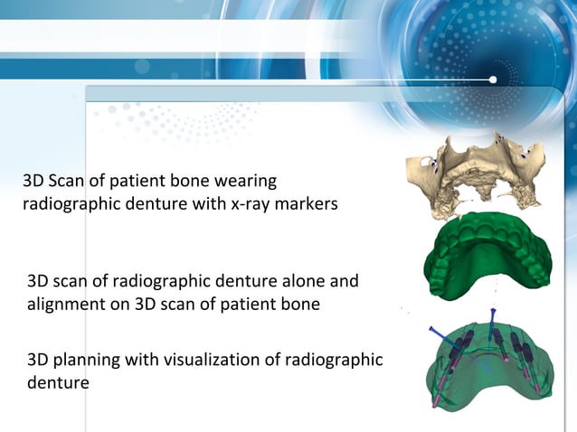 triple scan protocol (Dr. Gross) - a new and effective protocol for 3D ...
