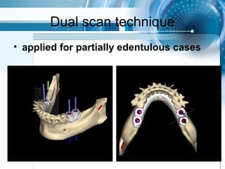 triple scan protocol (Dr. Gross) - a new and effective protocol for 3D ...