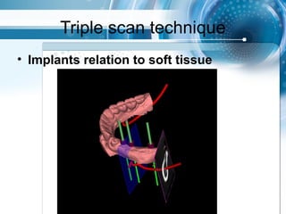 triple scan protocol (Dr. Gross) - a new and effective protocol for 3D ...