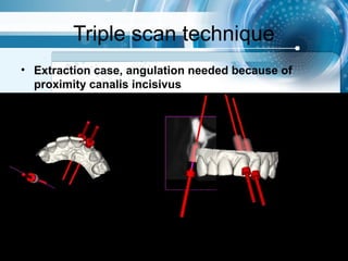 triple scan protocol (Dr. Gross) - a new and effective protocol for 3D ...