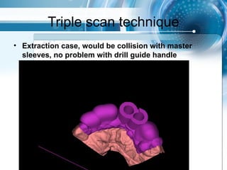 triple scan protocol (Dr. Gross) - a new and effective protocol for 3D ...