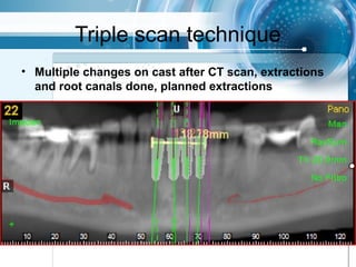 triple scan protocol (Dr. Gross) - a new and effective protocol for 3D ...