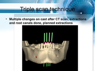 triple scan protocol (Dr. Gross) - a new and effective protocol for 3D ...