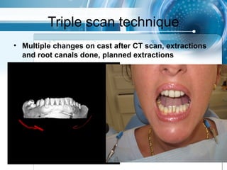triple scan protocol (Dr. Gross) - a new and effective protocol for 3D ...
