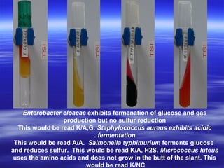Triple Sugar Iron Agar Salmonella