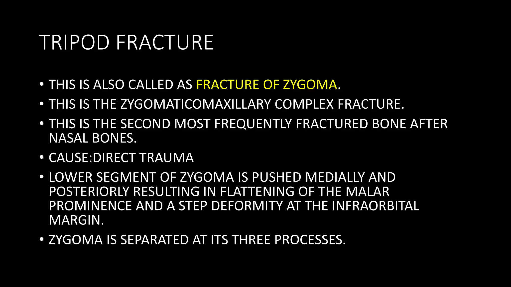 Tripod fracture | PPTX | Death, Injury, or Military Conflict ...