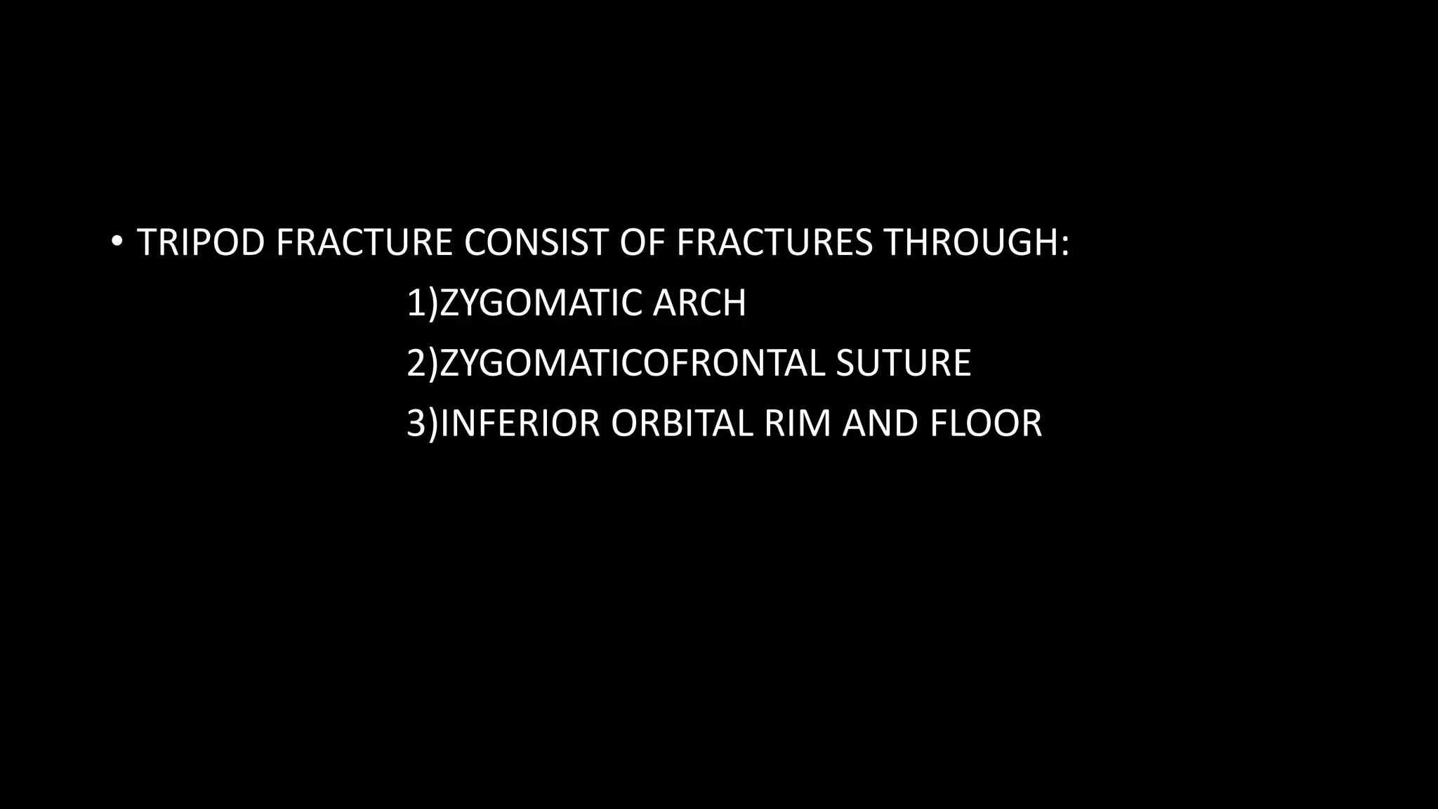 Tripod fracture | PPTX