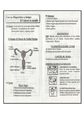 Triptico cancer cuello uterino | PDF