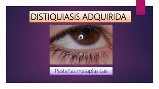 Triquiasis y distiquiasis | PPTX