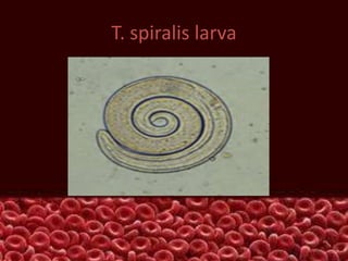 Triquinelosis (triquinosis) | PPTX