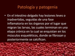 Triquinelosis (triquinosis) | PPTX
