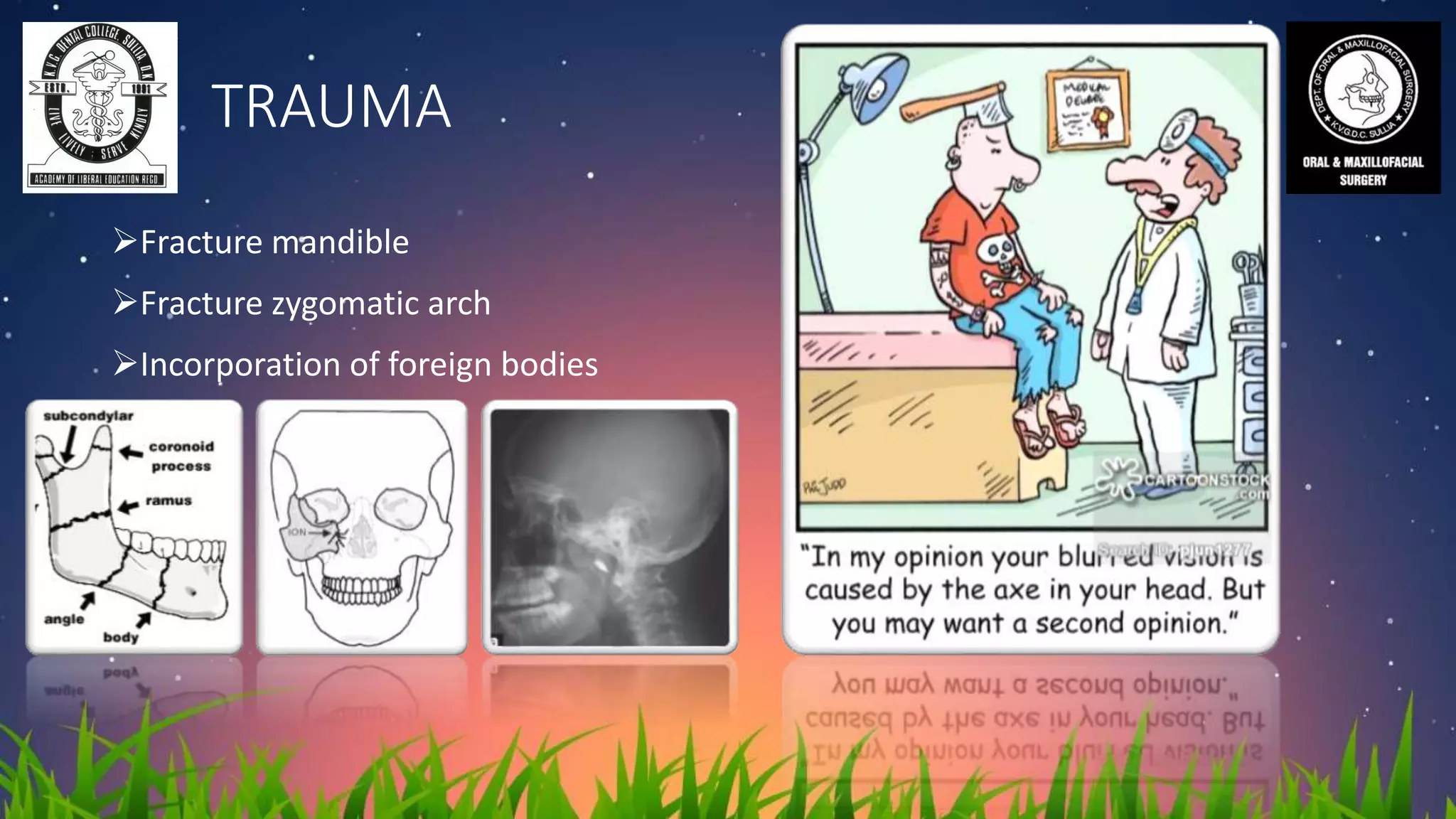 Differential Diagnosis of Trismus | PPTX