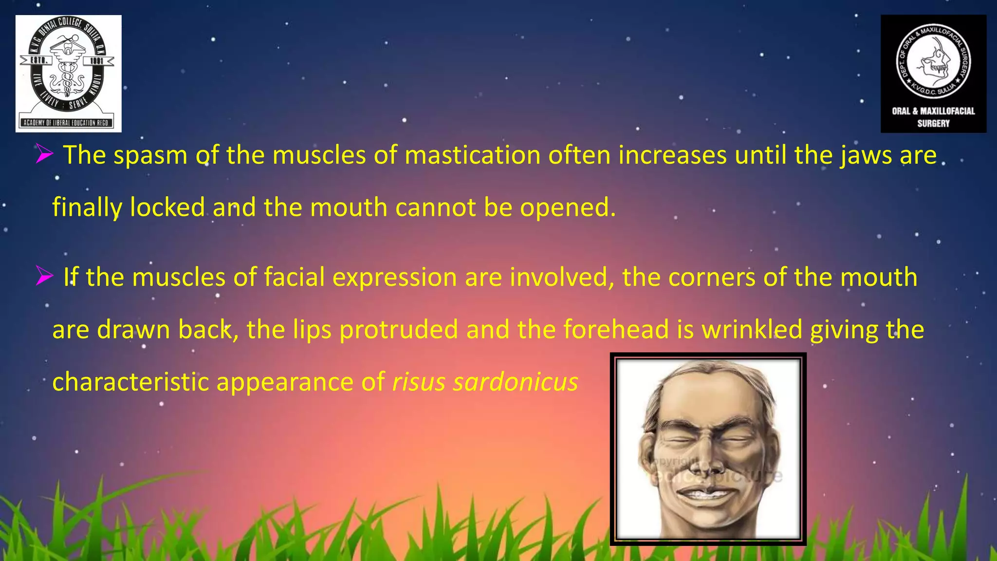 Differential Diagnosis of Trismus | PPTX