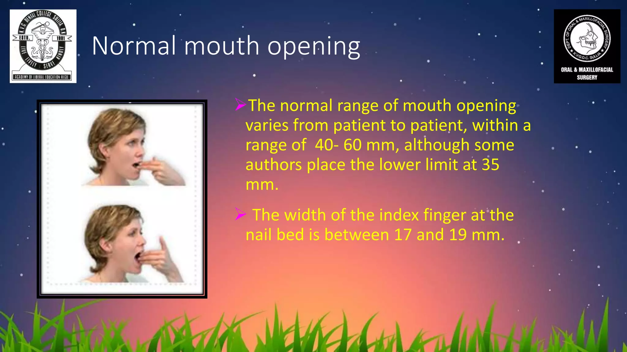 Differential Diagnosis of Trismus | PPTX