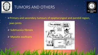 Differential Diagnosis of Trismus | PPTX