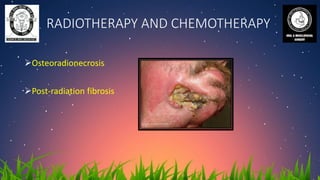 Differential Diagnosis of Trismus | PPTX