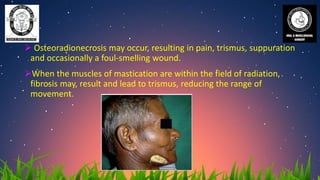 Differential Diagnosis of Trismus | PPTX