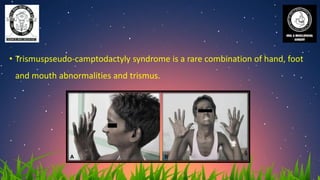 Differential Diagnosis of Trismus | PPTX