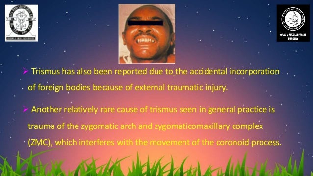 Differential Diagnosis of Trismus