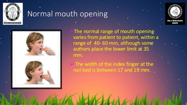 Differential Diagnosis of Trismus