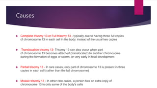 Trisomy 13 | PPTX