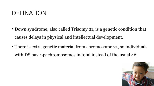 Comprehensive nursing responsibilities of a child with trisomy 18,13 ...