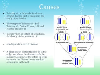 Trisomy 18 | PPT